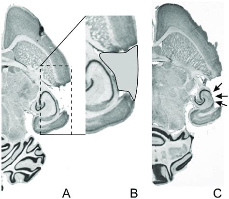 Histological Verification Of Lesion Size And Location Shown Are Two