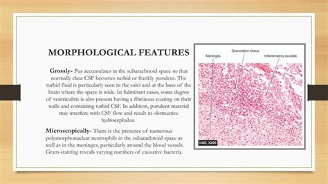 Pathology Of Meningitis Types Etiologypptx