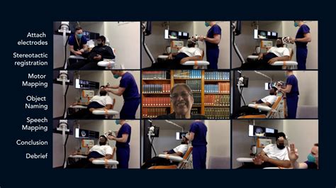 Catherine Lapp On Linkedin Nexstim Ntms Pre Surgical Language Mapping