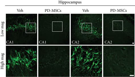 Human Placenta Derived Mesenchymal Stem Cells Pd Mscs Reduced