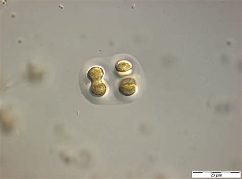 Chroococcus Limneticus