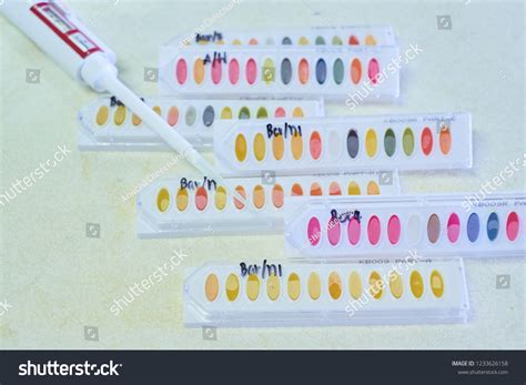 Biochemical Test Identification Bacteria Using Various Stock Photo