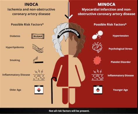 Minoca Inoca International