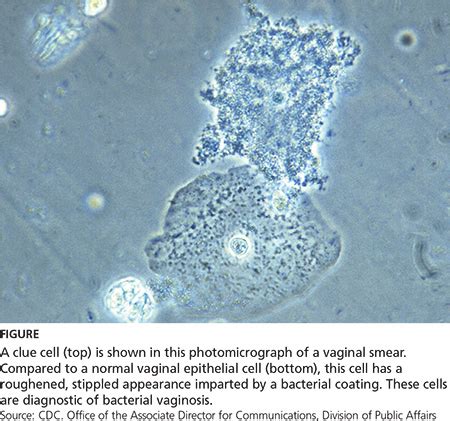 What Does Bv Look Like Under A Microscope Lab