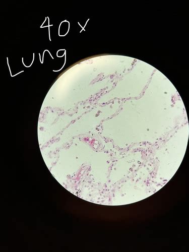Lab Practical Tissue Connective Flashcards Quizlet