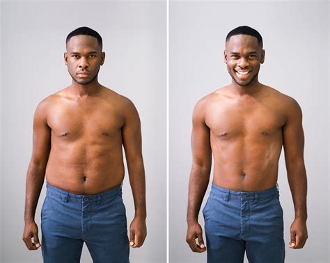 Weight Loss Program Uco Medical Clinic