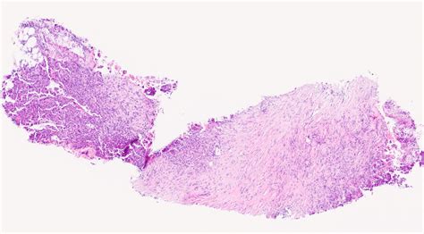 Issue With Registration Get A Registered Black Image