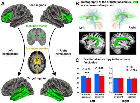 Arcuate Fasciculus Measurements A Seed And Target Regions As Well Download Scientific