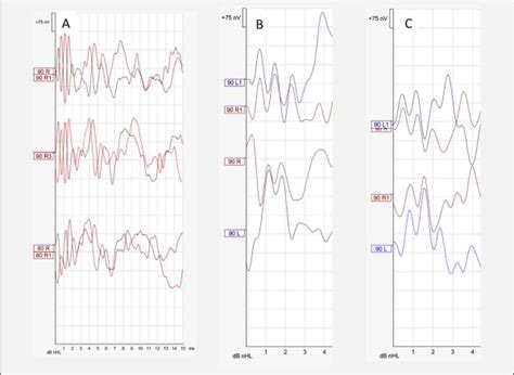 Cochlear Microphonics And Auditory Brainstem Responses To Condensation Download Scientific