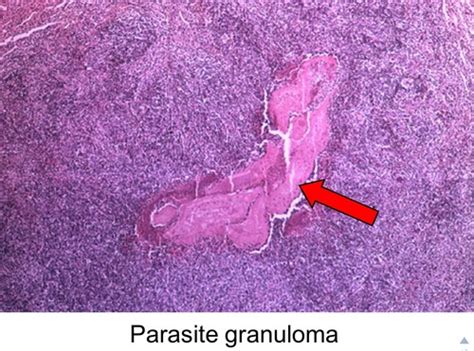 Bvm3 Ruminant Lungworm Flashcards Quizlet