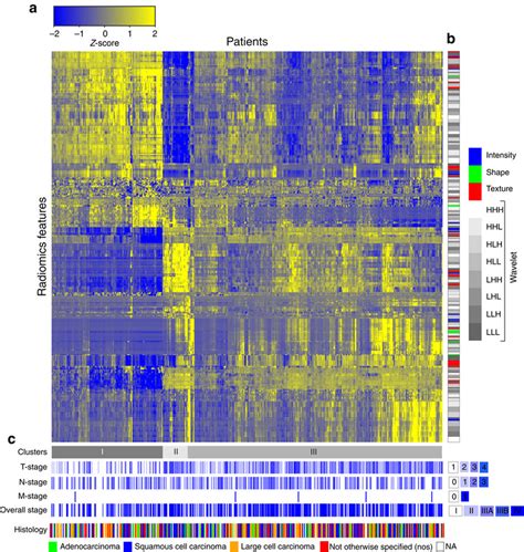 Radiomics Heat Map A Unsupervised Clustering Of Lung Cancer Patients