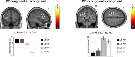 Fronto Parietal Brain Responses To Visuotactile Congruence In An Anatomical Reference Frame