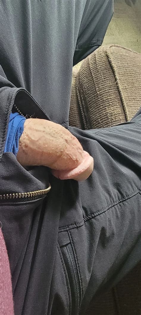 My Split Glans 12 Pics Xhamster