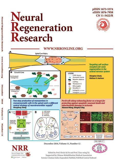 Pdf Extremely Low Frequency Electromagnetic Fields Stimulation Modulates Autoimmunity And
