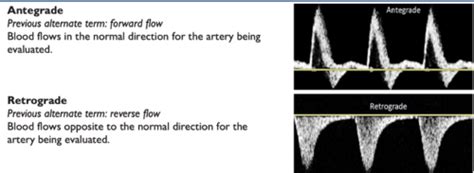 Interpretation Of Peripheral Arterial And Venous Doppler Waveforms Flashcards Quizlet