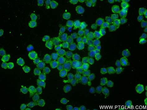 Piezo1 Extracellular Domain Antibody 82625 4 Pbs Proteintech