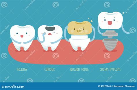 Healthy Tooth Carious Golden Tooth Crown Imp Stock Illustrations 1