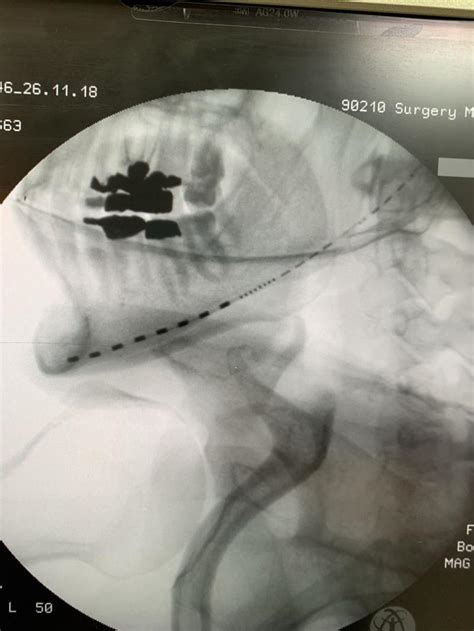 Shamlooelitespinepaininstitute Stimulation Ben Shamloo Md Fipp