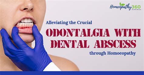 Alleviating The Crucial Odontalgia With Dental Abscess Through