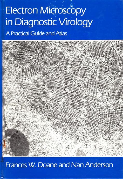 Electron Microscopy In Diagnostic Virology A Practical Guide And Atlas Buy Online At Best