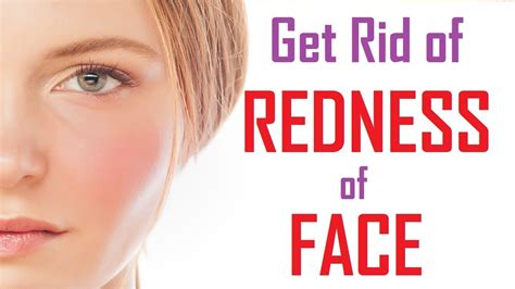 Best Of The Best Info About How To Get Rid Of Redness Quick Postmary11