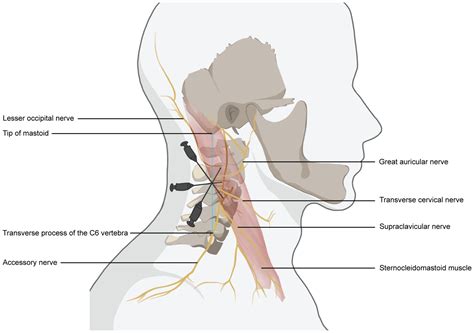 Frontiers Combination Of Ultrasound Guided Superficial Cervical Plexus Block And Local
