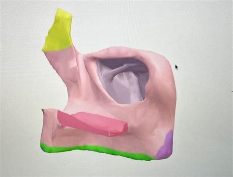 Select The Zygomatic Process