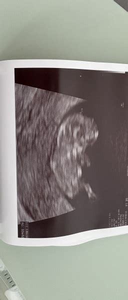 Skull Theory Gender Prediction Bit Of Fun Mumsnet