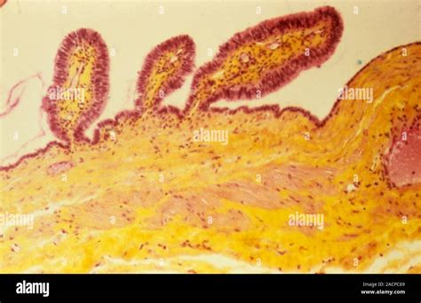 Paratubal Cysts Light Micrograph Of A Section Through A Fallopian Tube