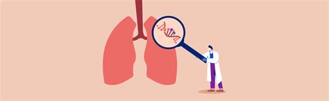 Roche Biomarker Testing Unlocking The Unknown About Lung Cancer