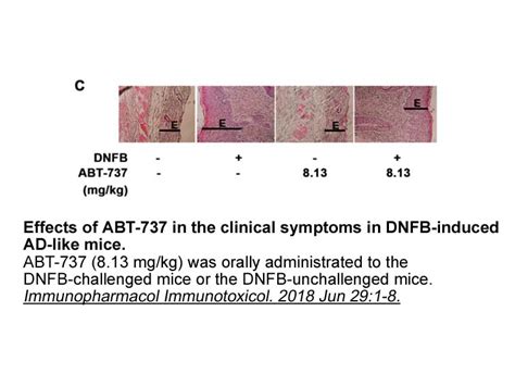 Apexbio Abt 737bcl 2 Inhibitorcas 852808 04 9