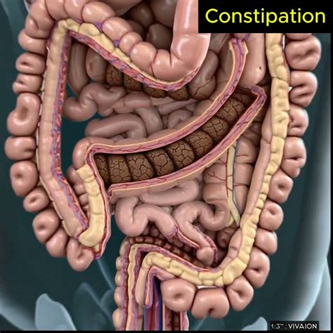 Slow Motion Constipated Stool Exit Human Anatomy 130 Youtube