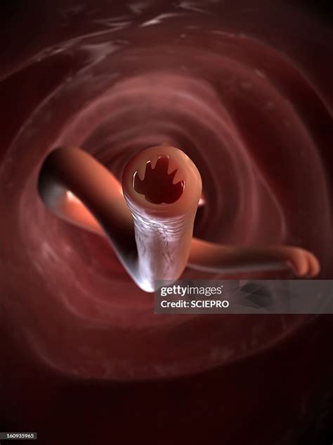 Hookworm Artwork High Res Vector Graphic Getty Images