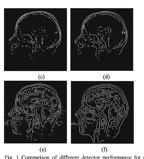 Figure 1 From Medical Image Edge Detection Method Based On Adaptive