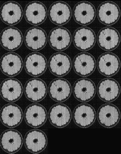 the dynamic mri experimental results using the hadamard encoding