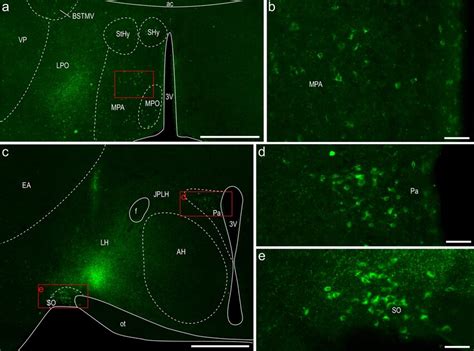 Retrograde Labeling In The Rostral Hypothalamus After Ctb Injection In