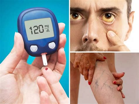 Diabetes Help 4 Friends Diabetes Symptoms In Men Top 7 Unusual Signs