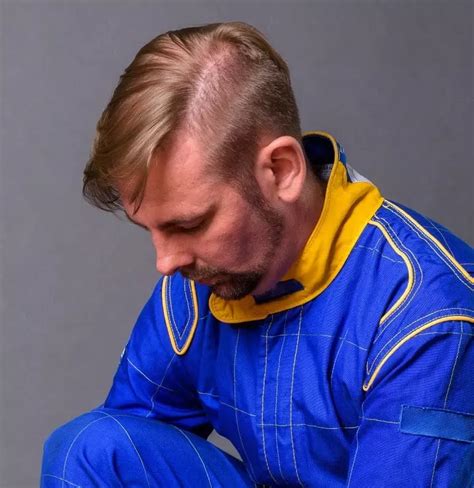 40 Haircuts For Balding Crown Hide Bald Spots Within Minutes Artofit
