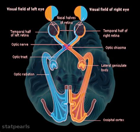 [figure Optic Chiasm Image Courtesy Dr Chaigasame] Statpearls Ncbi
