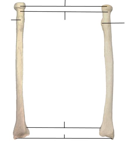 Radius Diagram Quizlet