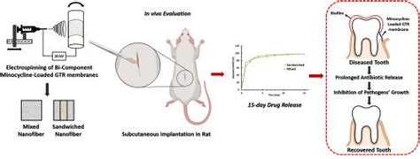 盐酸米诺环素纳米纤维膜的制备和评估在牙周引导组织再生中的潜力：体内释放和生物相容性分析 Journal Of Drug Delivery Science And Technology X Mol