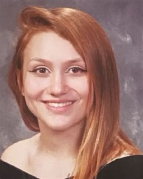 Orylan Spent 70k On Extreme Makeover Shocks With Before Photos