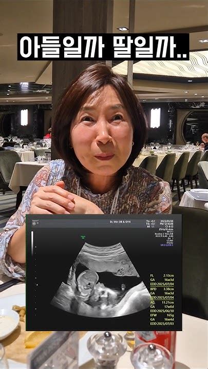 첫손주 성별 맞춰주세요 초음파 있음 아들 딸 Youtube