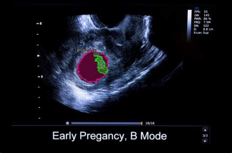 5 Industries Where Data Annotation Precision Is Critically Keymakr