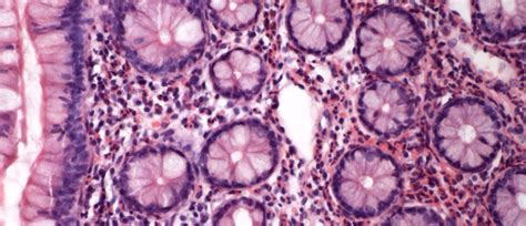 How To Prevent Gastroenteritis World Economic Forum