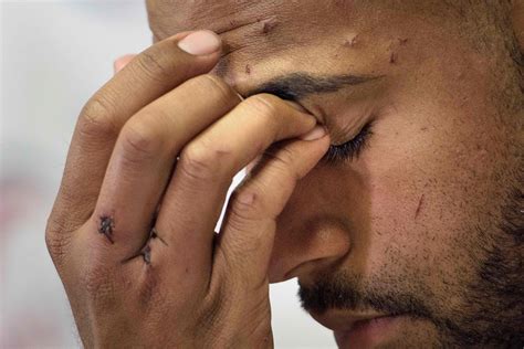 Orlando Survivors Recall Night Of Terror ‘then He Shoots Me Again