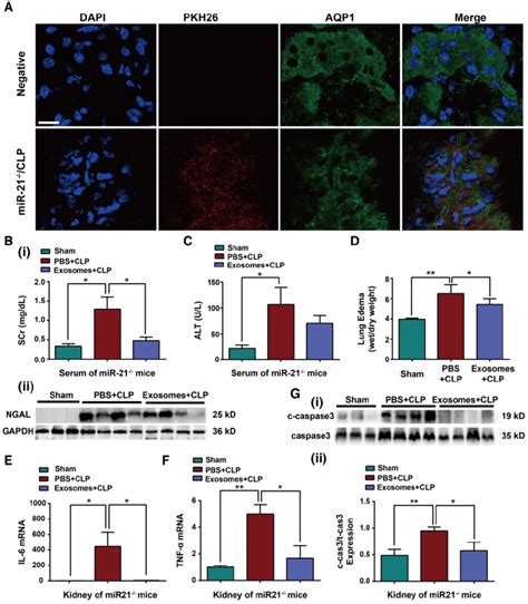Exosomal Mir 21 Rescues The Organ Dysfunction Of Mir 21 Mice With Clp