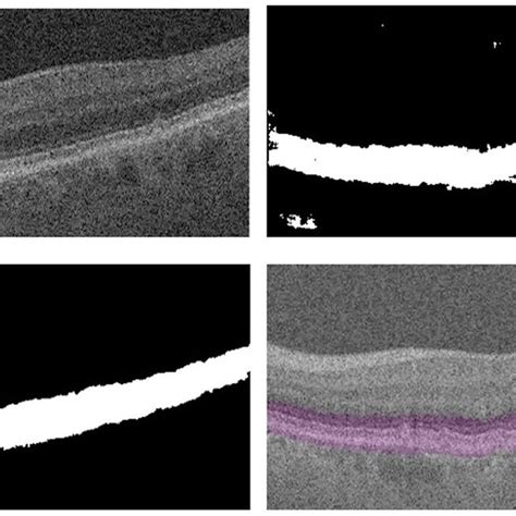 Left Densenet121 Architecture Right Dense Block Conv Block And Download Scientific
