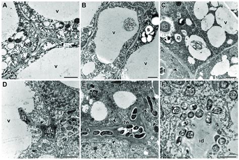 Ultrastructural Organization Of Nodules Of Pea Laboratory Line