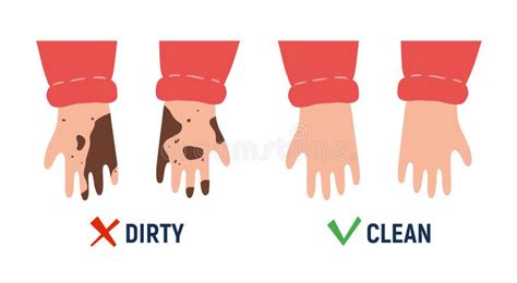 Dirty And Clean Hand Hygiene Poster Stock Vector Illustration Of